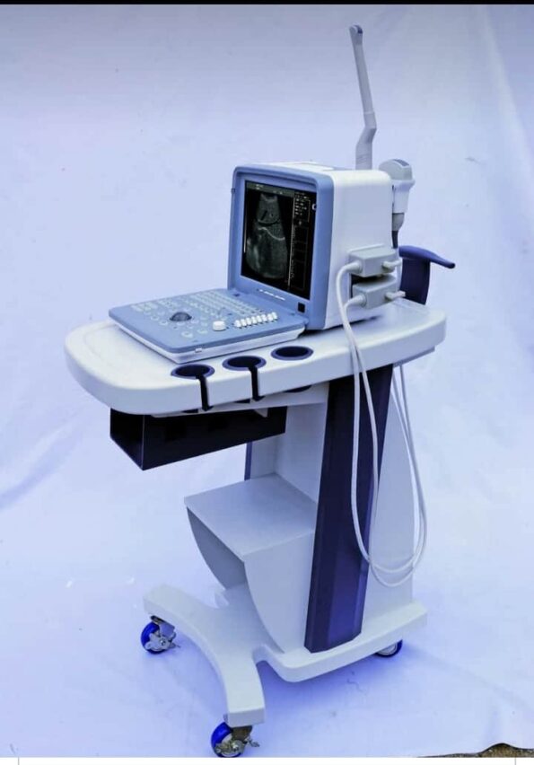 Biack and white Ultrasound Scanner with 2 probes and printer – Radmed